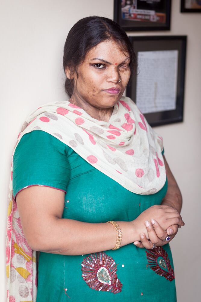 India’s Acid Attack Victims Are Helping Each Other Thrive