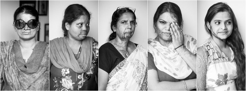 India’s Acid Attack Victims Are Helping Each Other Thrive