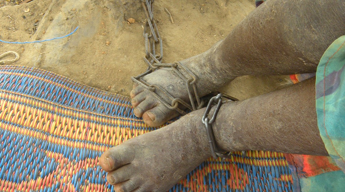 In West Africa, Mental Illness Is Treated With Chains & Shackles