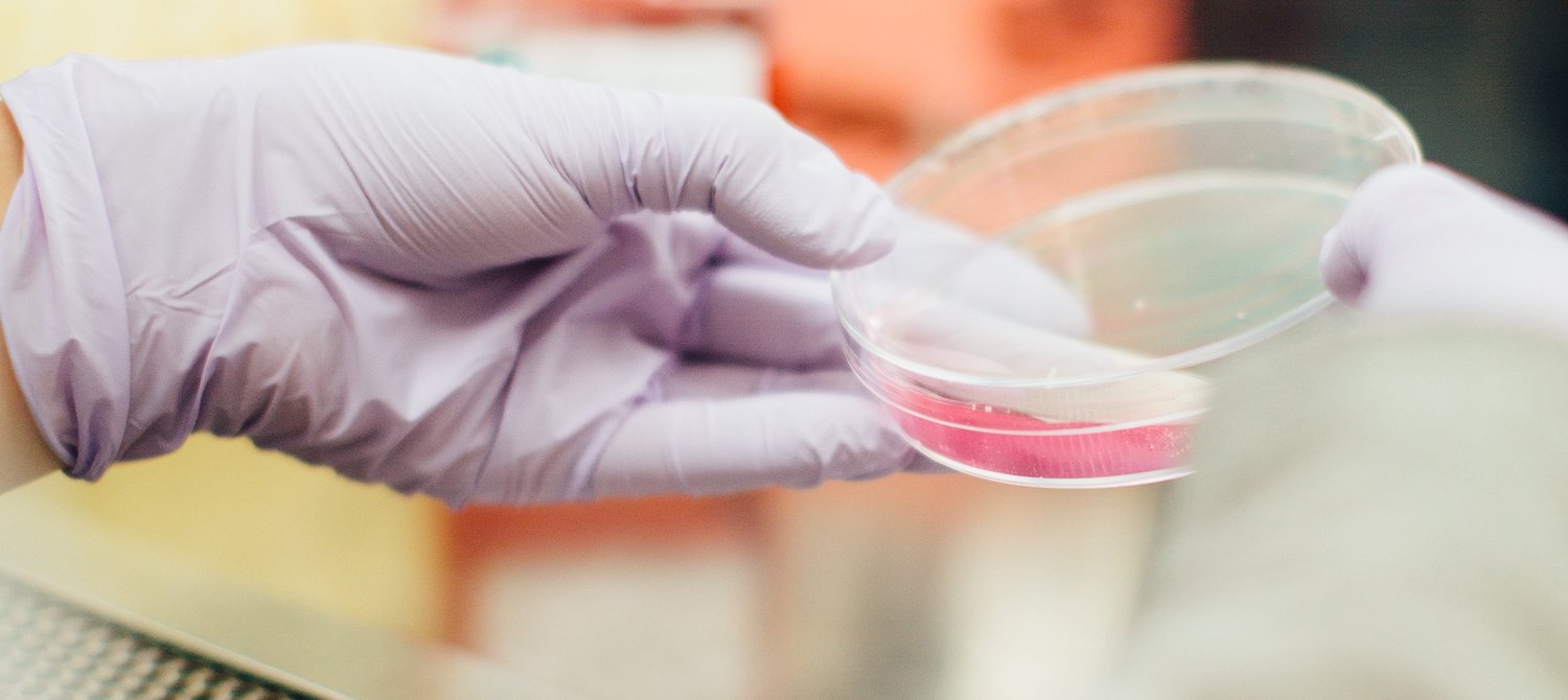 A Superbug Fungus Is Spreading in the US: What You Need to Know